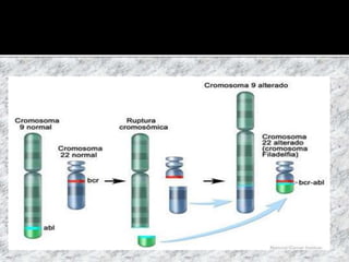 Leucemia slide | PPTX