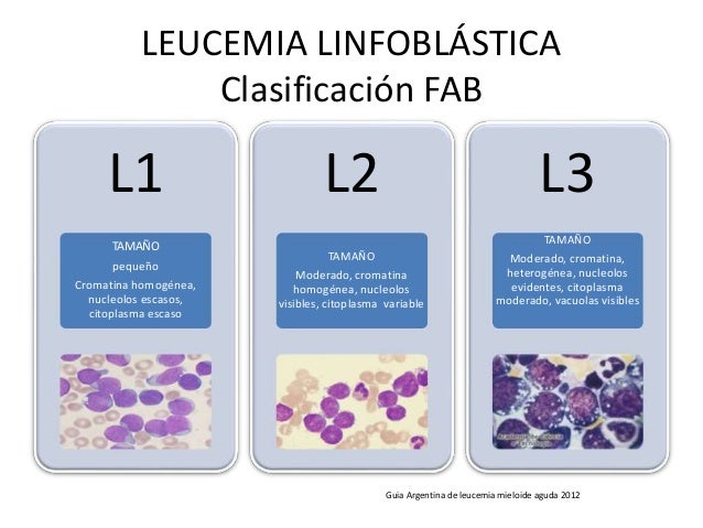 Leucemia aguda