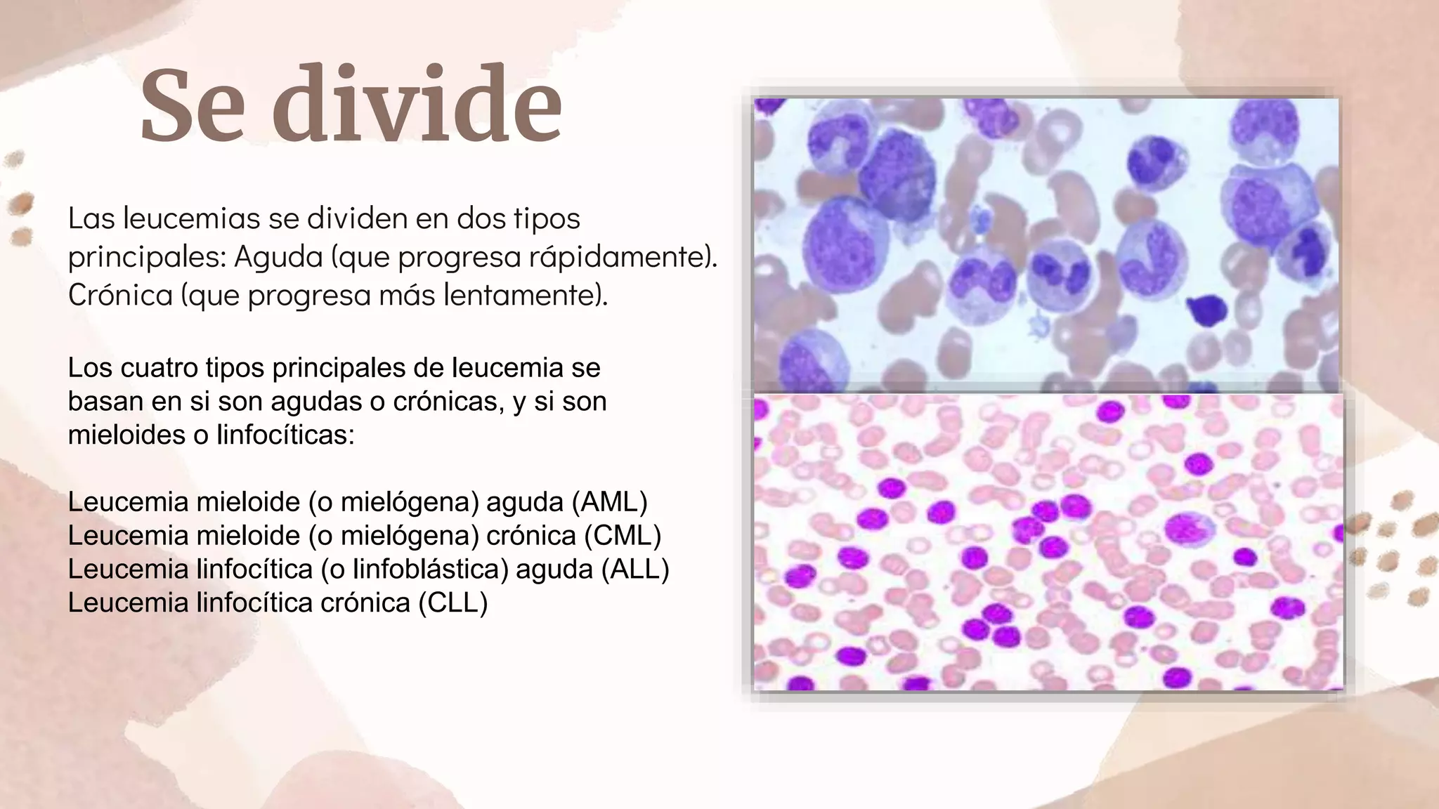 LEUCEMIA_BIOLOGIA_P3 (1).pptx