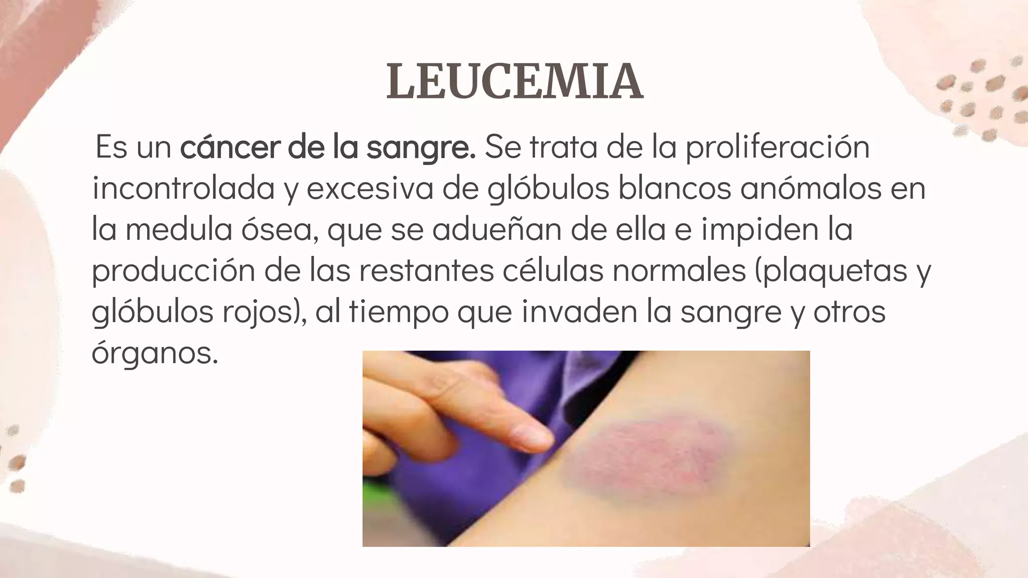 LEUCEMIA_BIOLOGIA_P3 (1).pptx