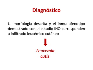Leucemia cutánea, leucemia cutis | PPT