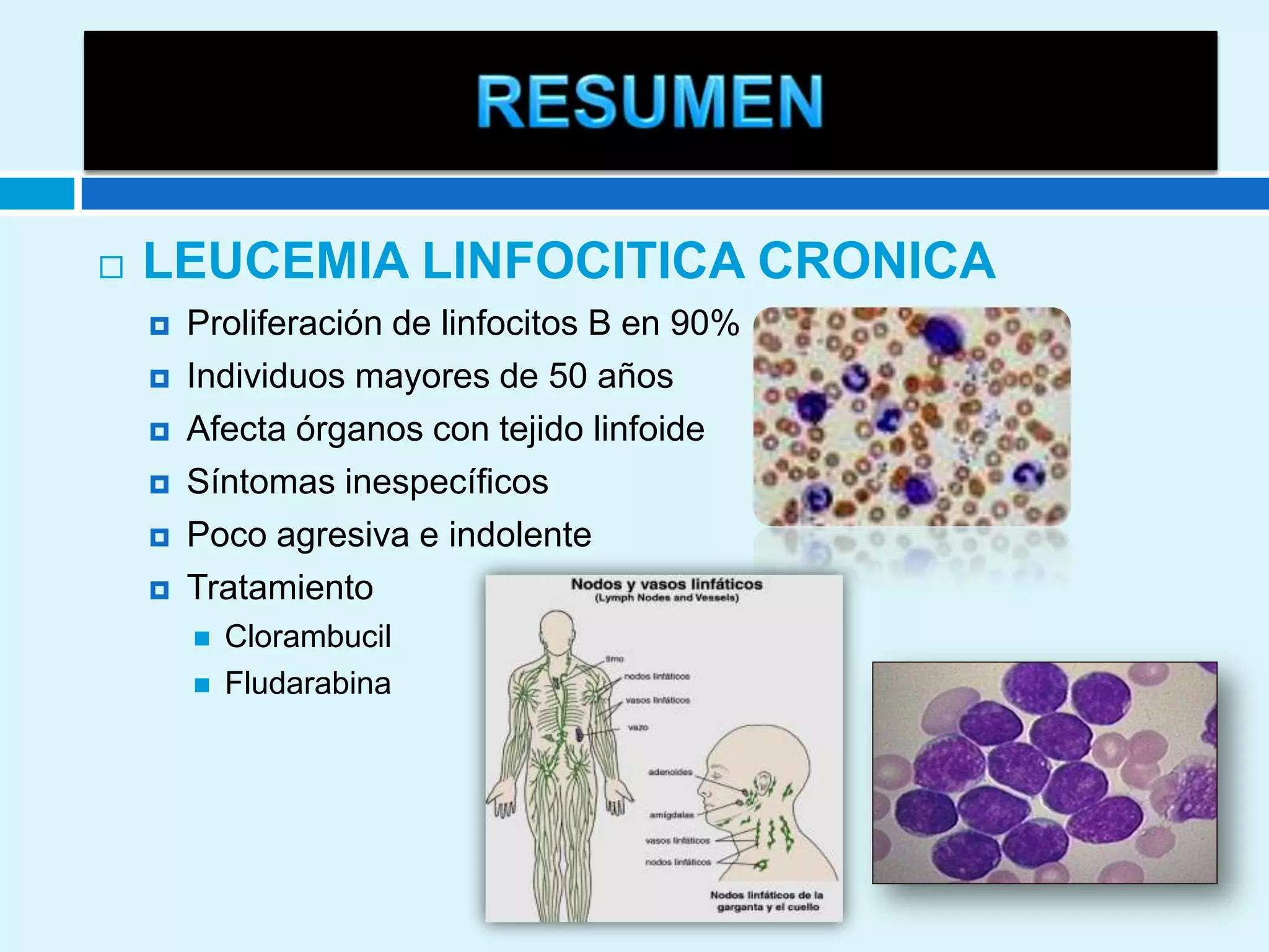 Leucemia De Celulas Peludas | PPT