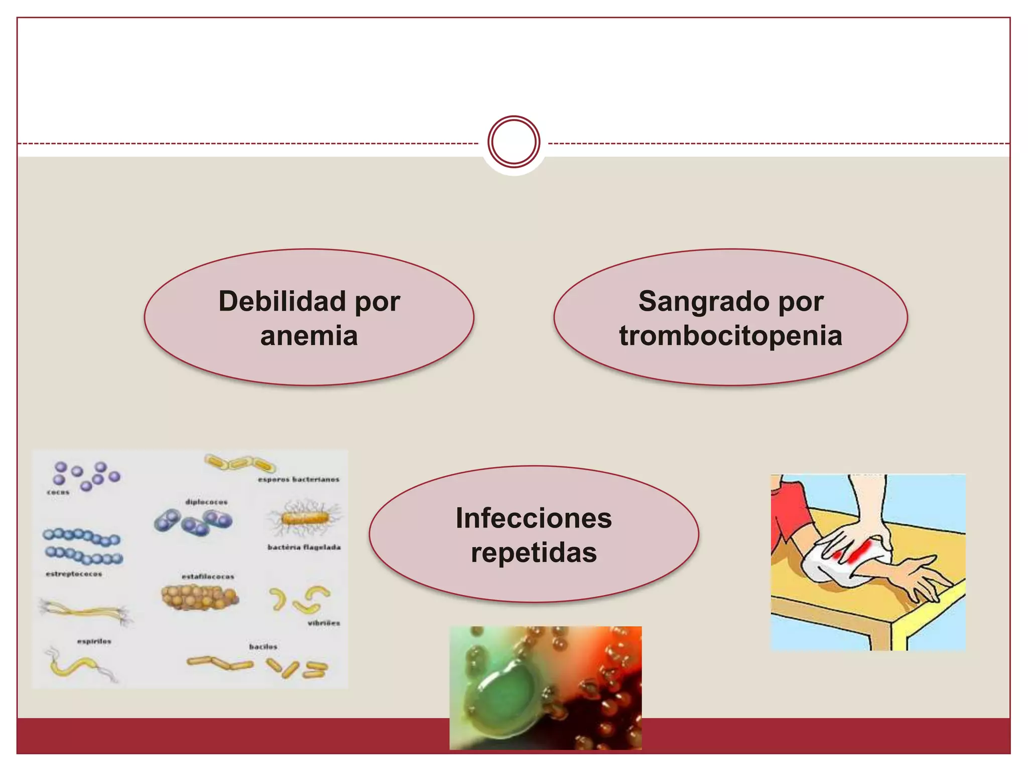 Leucemia De Celulas Peludas | PPTX