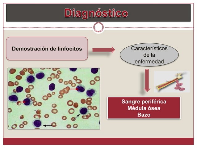 Leucemia De Celulas Peludas | PPTX