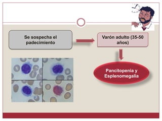 Leucemia De Celulas Peludas | PPTX