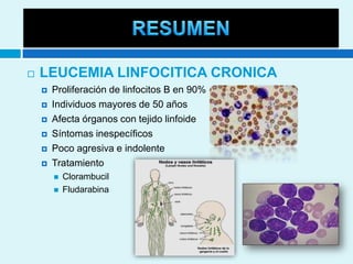 Leucemia De Celulas Peludas | PPTX