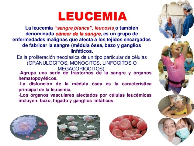 Leucemia Enfermedad: Leucemia