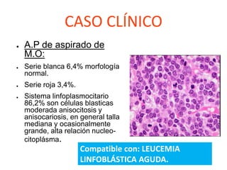 Leucemia linfoblastica aguda | PPTX