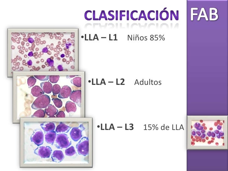 Leucemia LinfobláStica Aguda