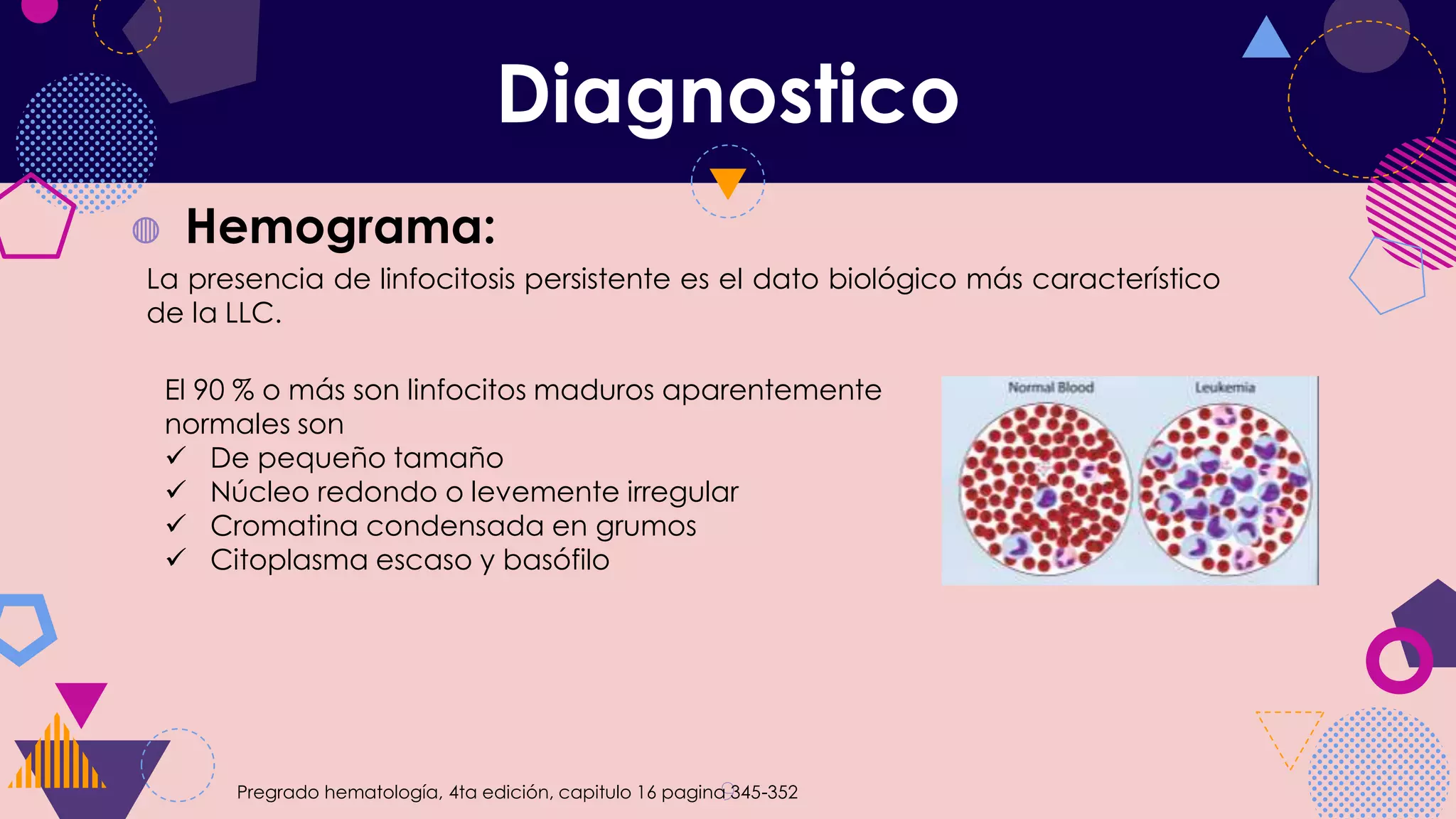Leucemia linfocitica cronica | PPT Leucemia linfocitica cronica | PPT