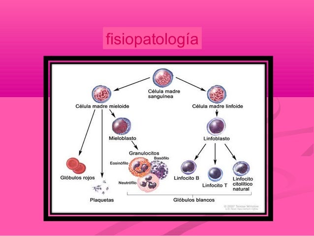 Leucemia linfoide aguda ruby