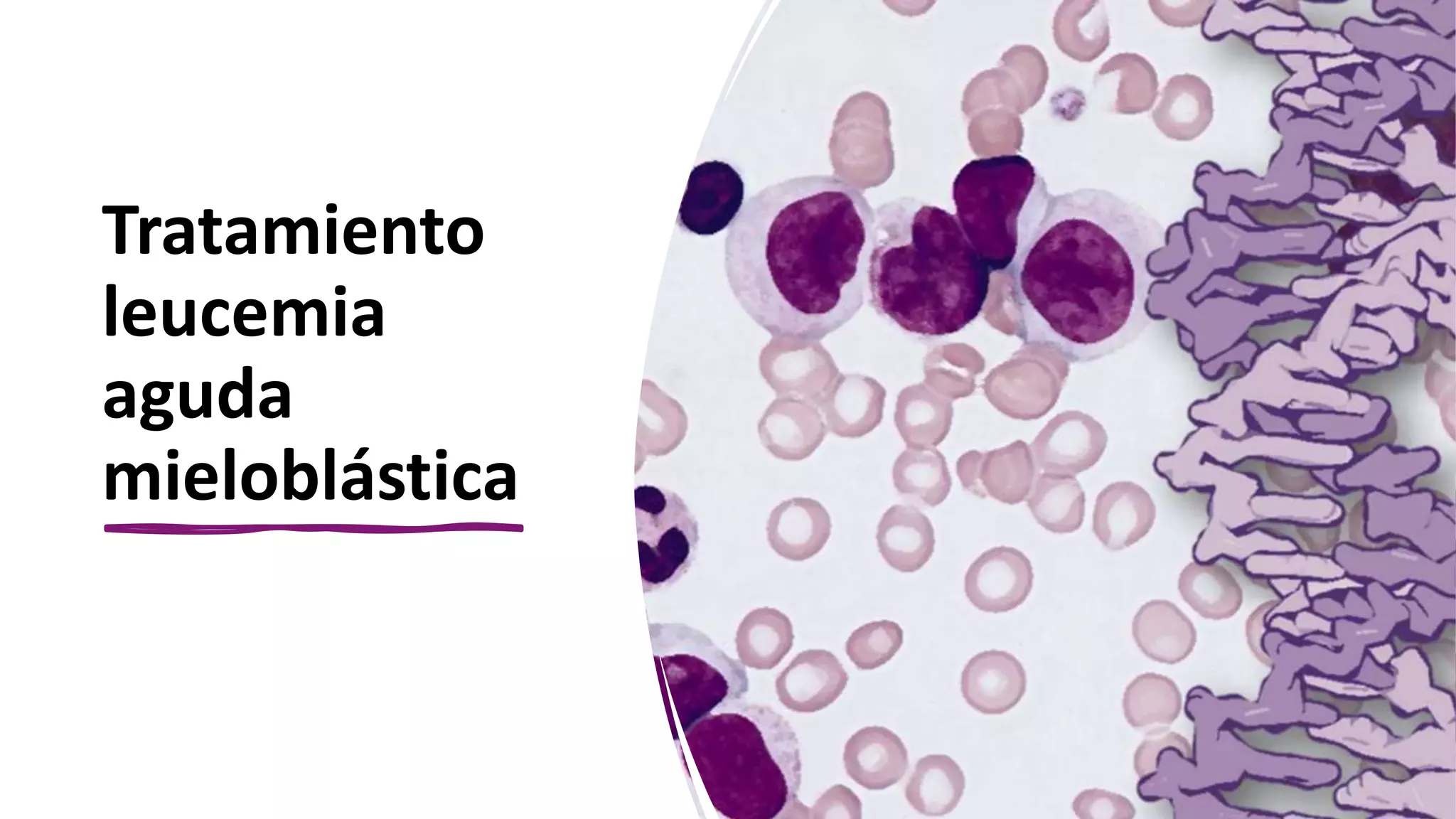LEUCEMIA MIELOBLASTICA AGUDA - HEMATOLOGIA.pptx