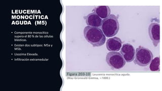LEUCEMIA MIELOIDE AGUDA.pptx