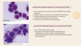 LEUCEMIA MIELOIDE AGUDa PRESENTACIÓN DE LEUCEMIA | PPTX