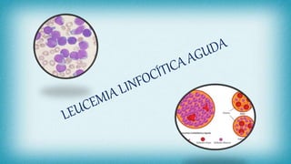 Leucemia y tipos de Leucemia ppt | PPTX