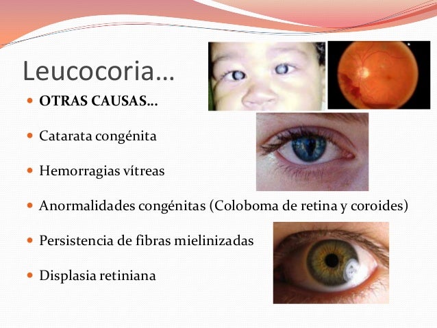 Leucocoria