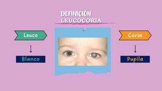 leucocoria | PPTX