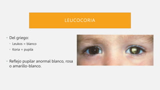 Leucocoria.pptx