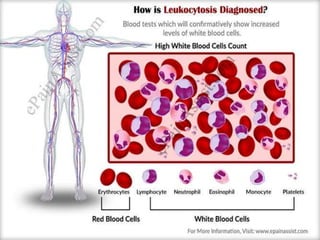 Leucocytosis and leucopenia | PPTX