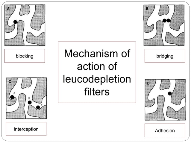 Leucodepletion | PPTX