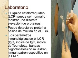 Leucoencefalopatía Multifocal Progresiva Pptx