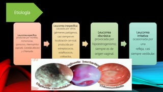 Leucorrea.pptx