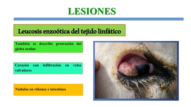 Leucosis bovina | PPT