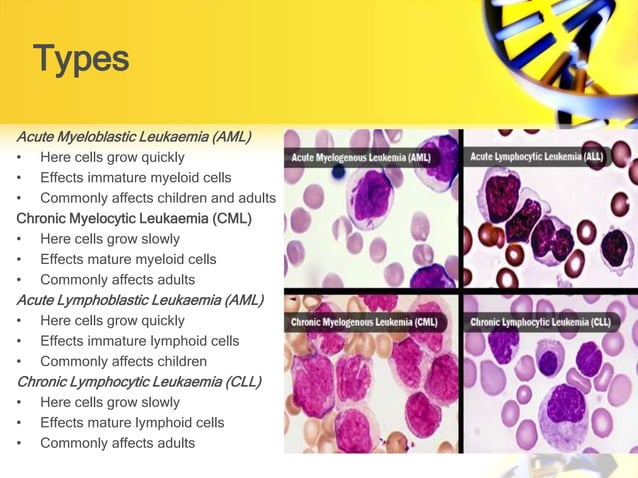 Leukaemia | PPTX | Blood Disorders | Diseases and Conditions