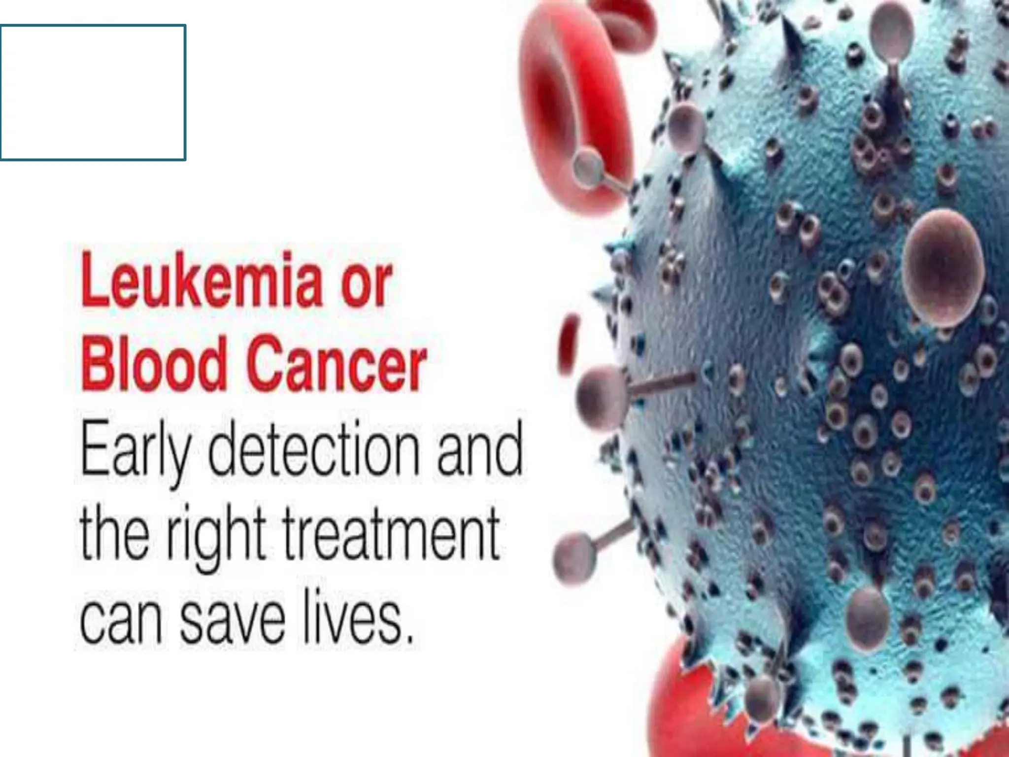leukaemia.pptx blood disorders bleeding wbc | PPT
