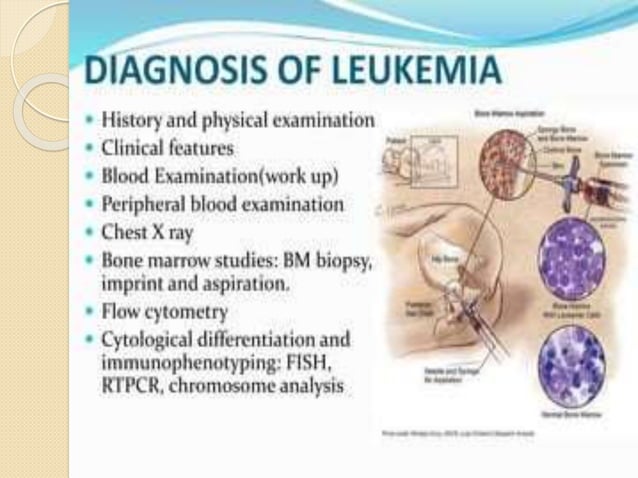 leukaemia.pptx blood disorders bleeding wbc | PPT