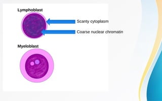 Myeloblast Vs Lymphoblast