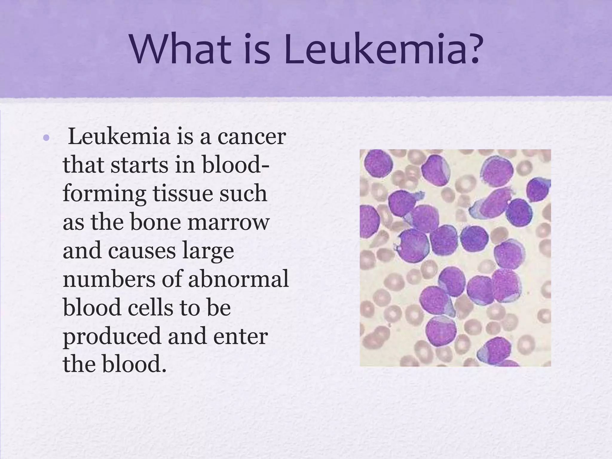 Leukemia | PPT