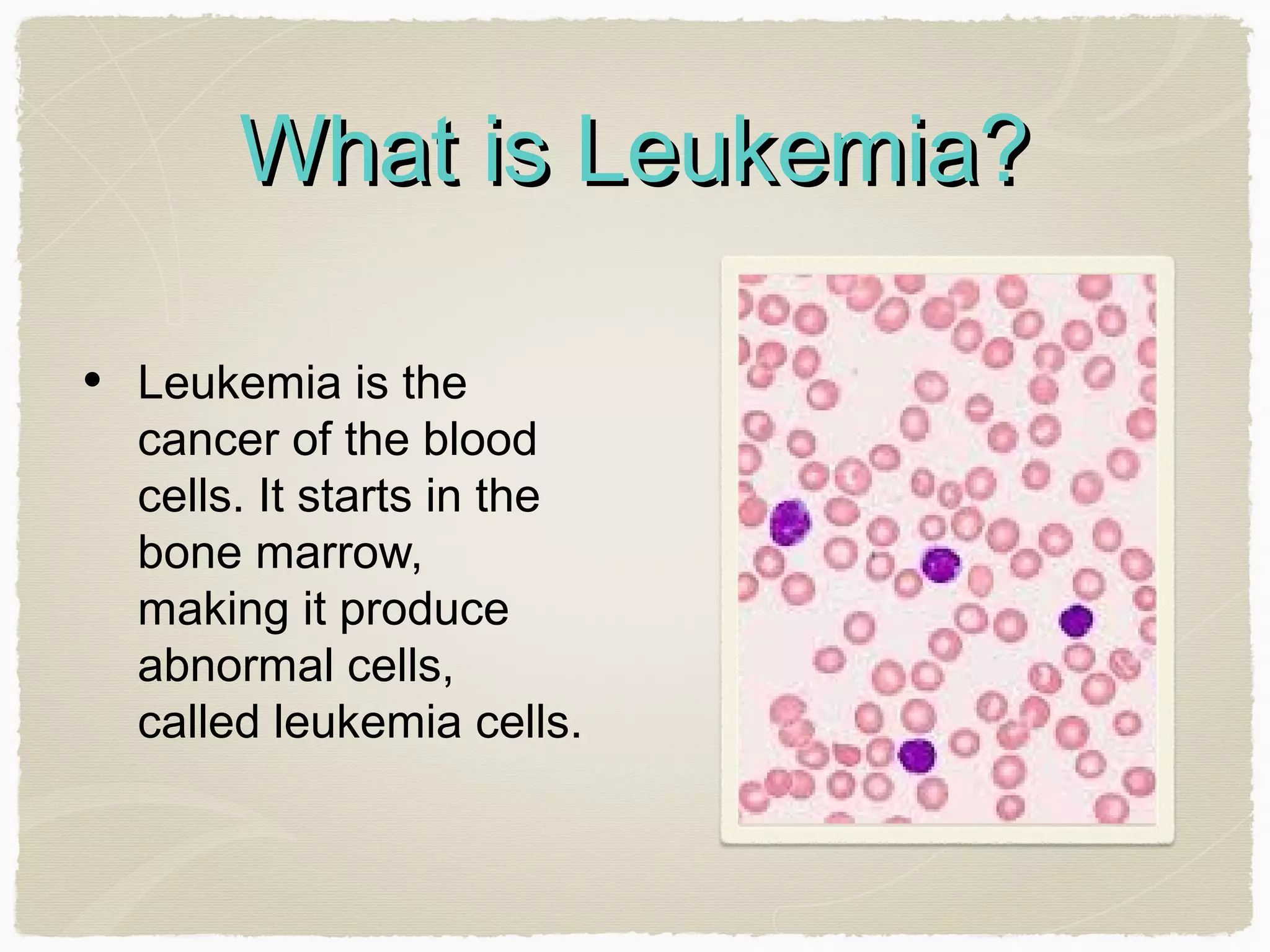 Leukemia | PPT