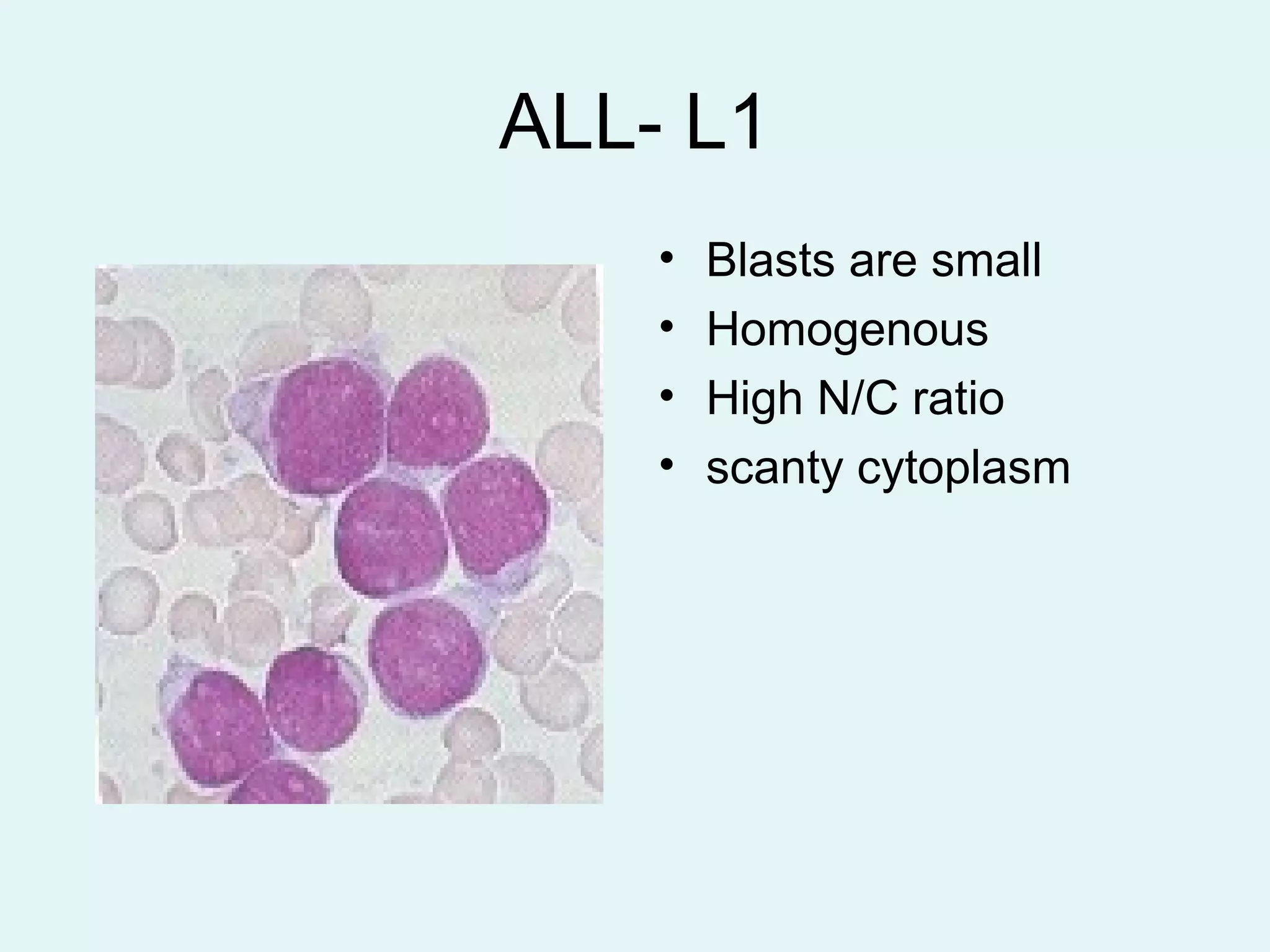 Leukemia | PPT
