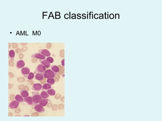 Leukemia | PPT | Blood Disorders | Diseases and Conditions