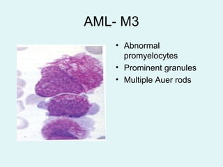 Leukemia | PPT