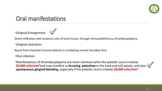 Dental Management of Patient with Leukemia | PPTX