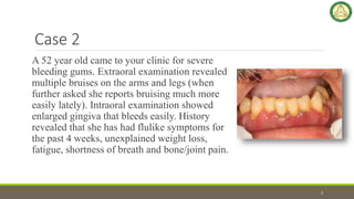 Dental Management of Patient with Leukemia | PPTX