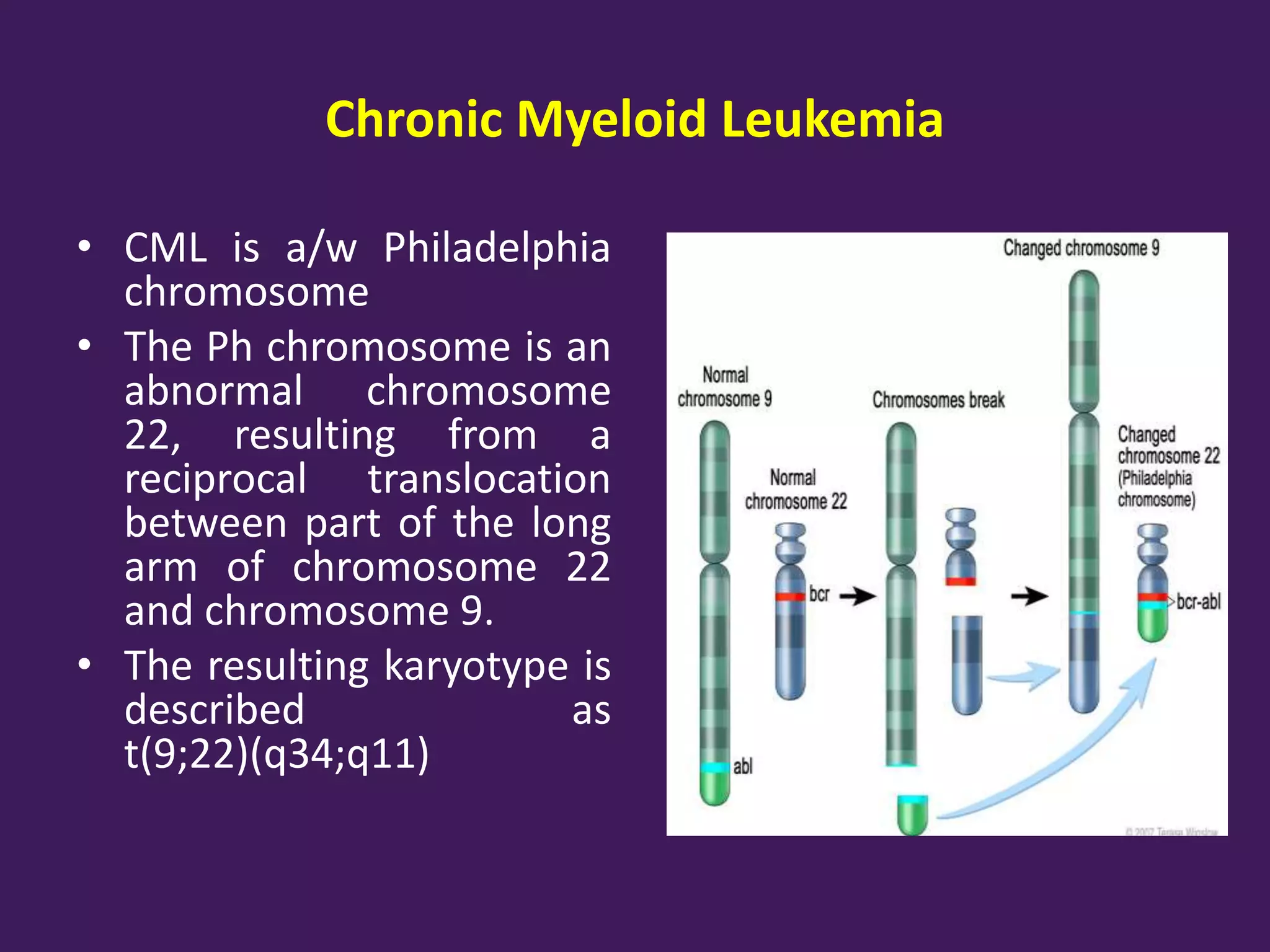 Leukemia , causes, clinical features, raktarbud | PPTX