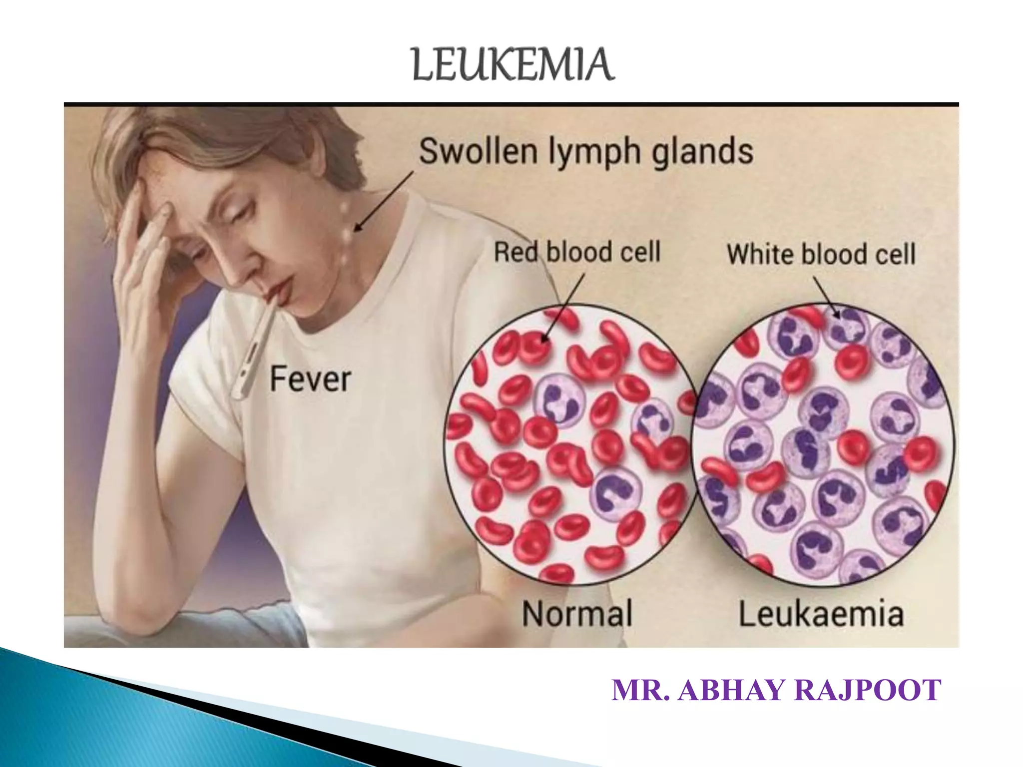 Leukemia | PPTX