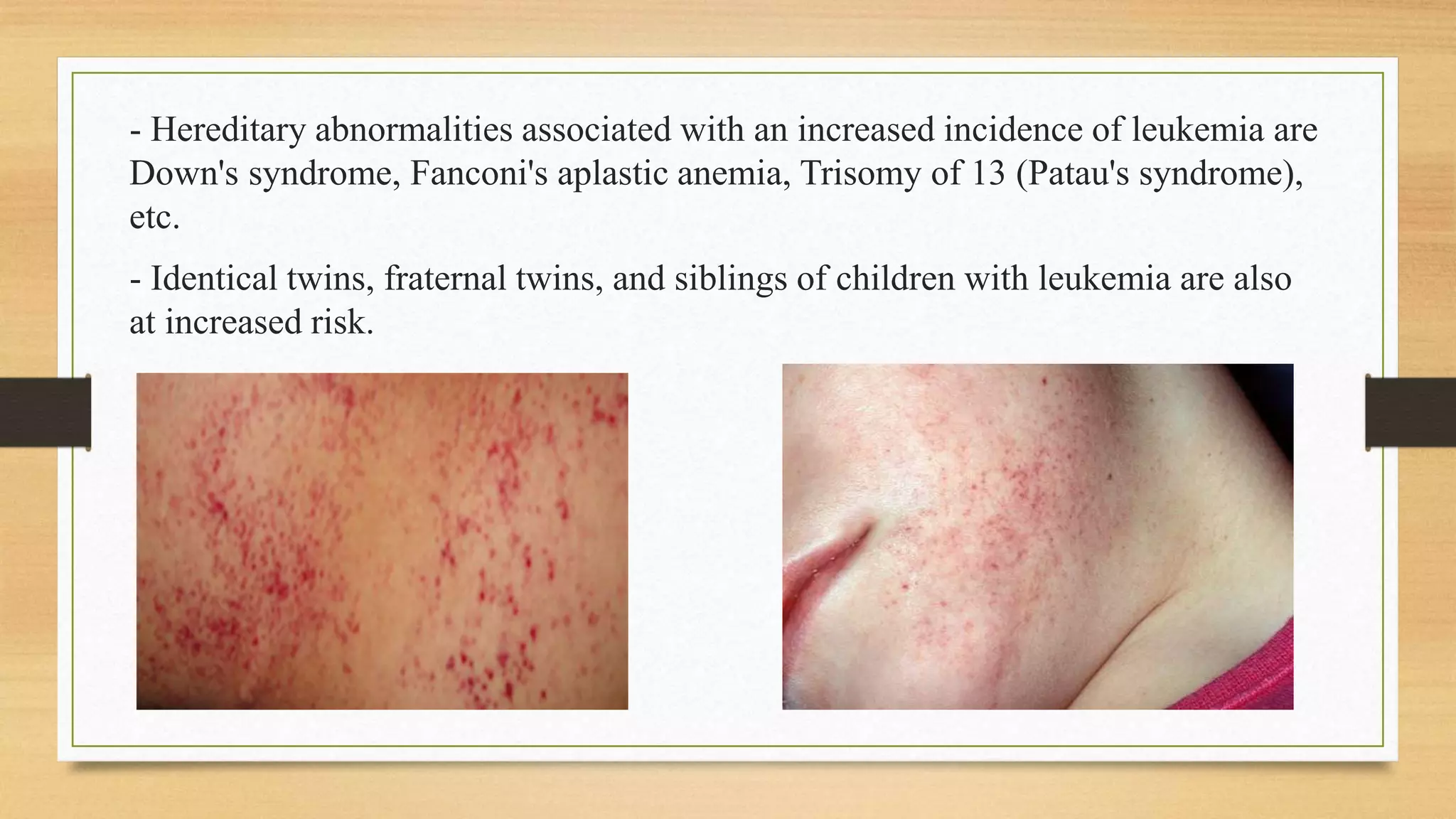 Leukemia (blood cancer) presentation | PPTX