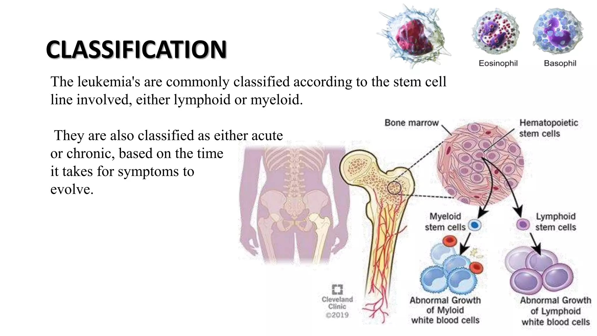 Leukemia | PPTX