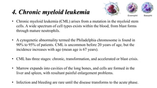 Leukemia | PPTX