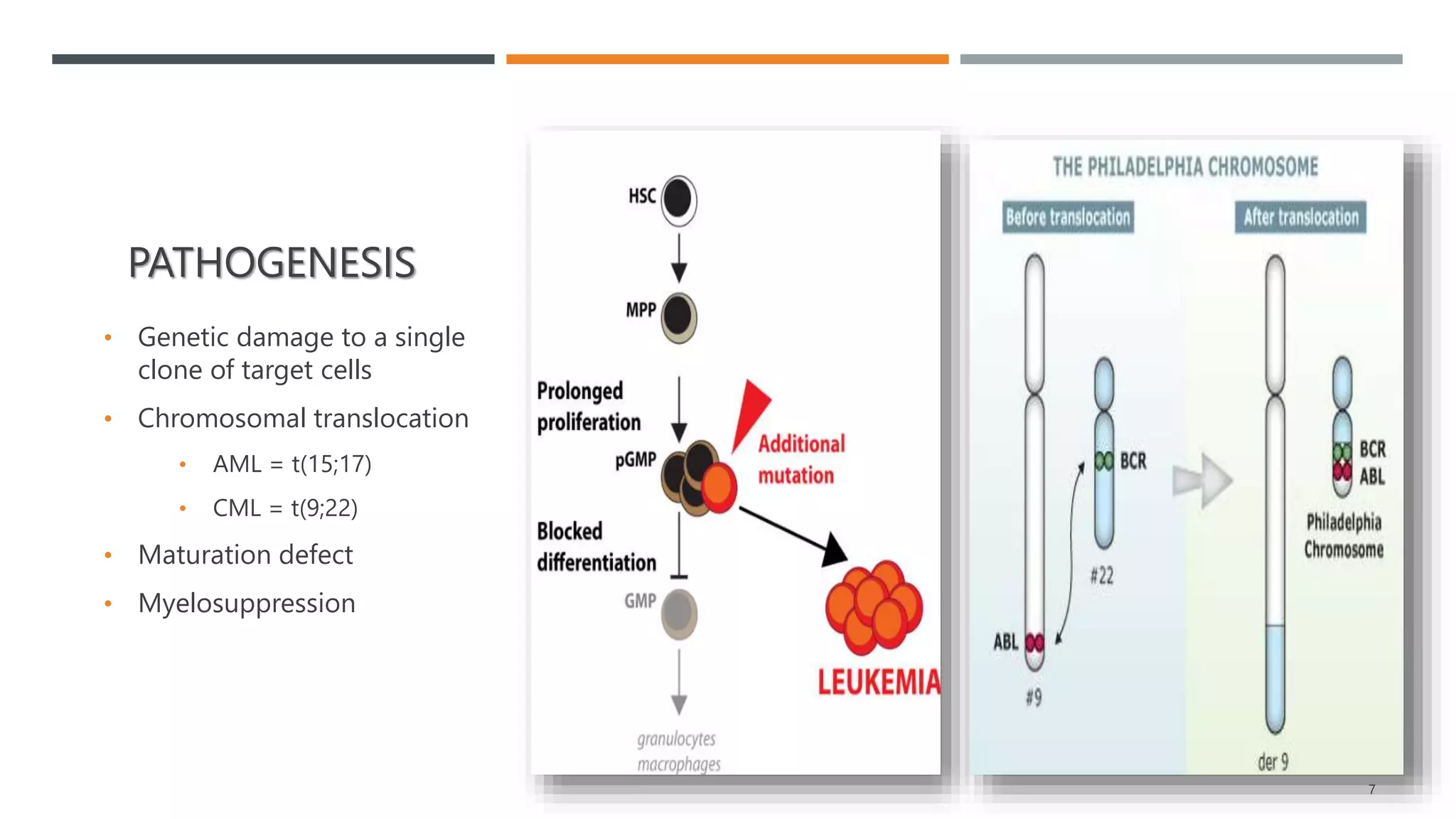 LEUKEMIA.pptx