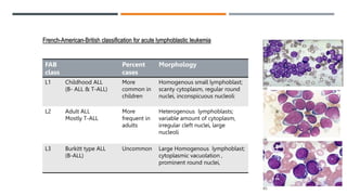 LEUKEMIA.pptx