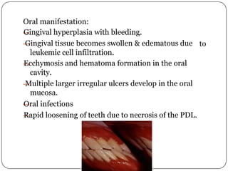 Leukemia .pptx. ........,.................. | PPTX