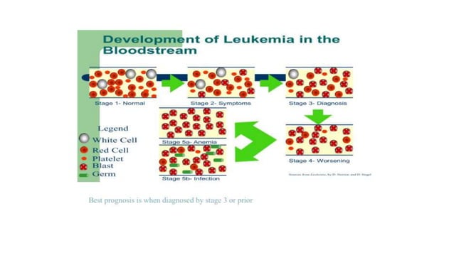 LEUKEMIALeukemia, historic perspective, etiology, risk factors ...