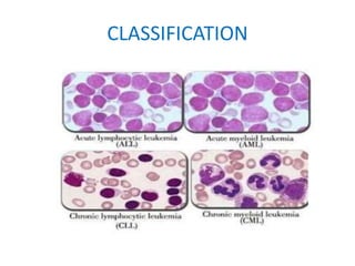 Acute and chronic leukemia description.pptx