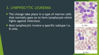 LEUKEMIA By Dr. Prashanth R Gadgade..... | PPTX