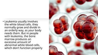 LEUKEMIA.pptx diagnosis and treatment of | PPTX
